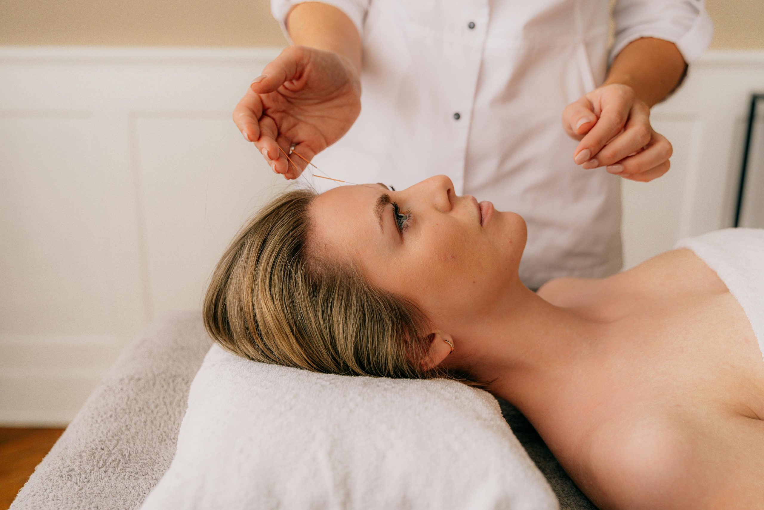 Acupuncture for Stress and Anxiety Relief | GD Osteopathy Enfield